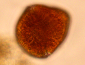 ヨロイオビムシ目 Order Gonyaulacales