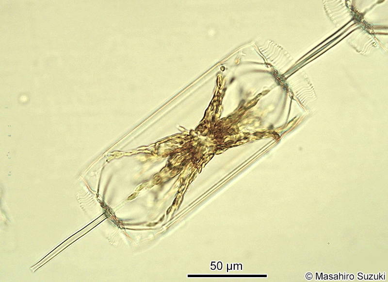 チョウチンケイソウ Ditylum brightwellii
