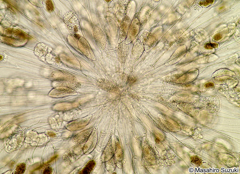 テマリワムシ Conochilus hippocrepis