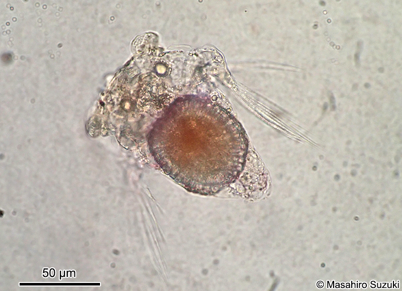ミジンコワムシ属の1種 Hexarthra sp.