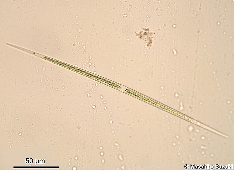 Closterium sp.